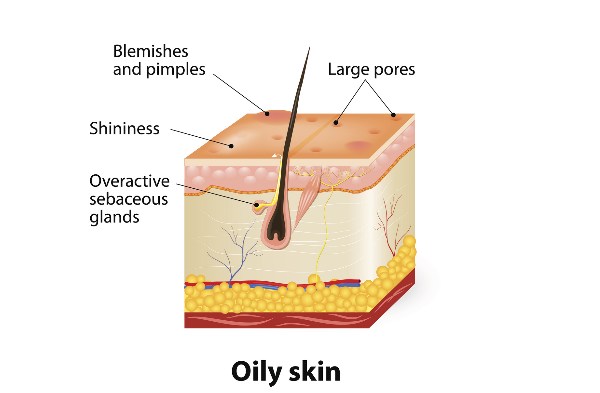 A.Vogel Talks Oily Skin