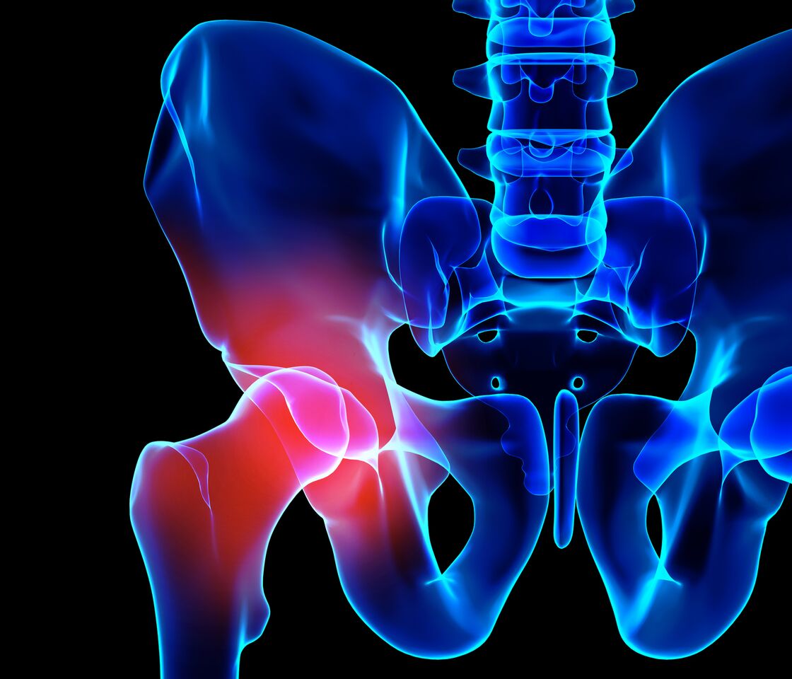 What Is The Muscle On Lower Back Above Hip Pain In Lower Back Right Side Causes Treatment And what-is-the-muscle-on-lower-back-above-hip-pain-in-lower-back-right-side-causes-treatment-and