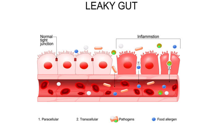 Can Probiotics Help With Allergies